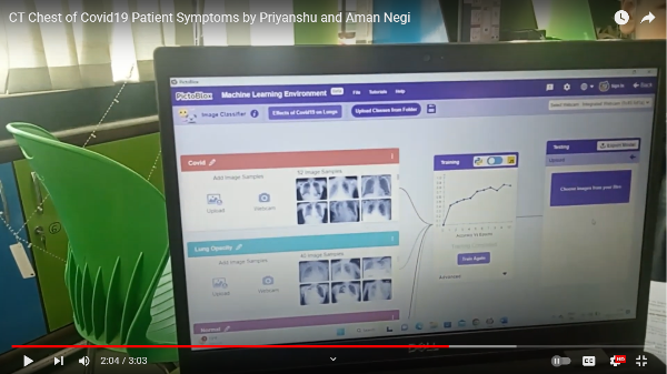 CT Chest of Covid19 Patient Symptoms - Codeavour 2022